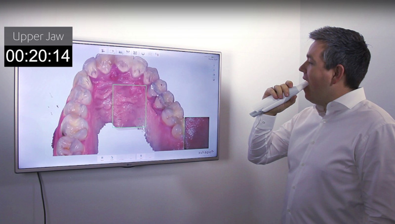 Mandibular Advancement Splints (MAS) | Cardio Respiratory Sleep Australia